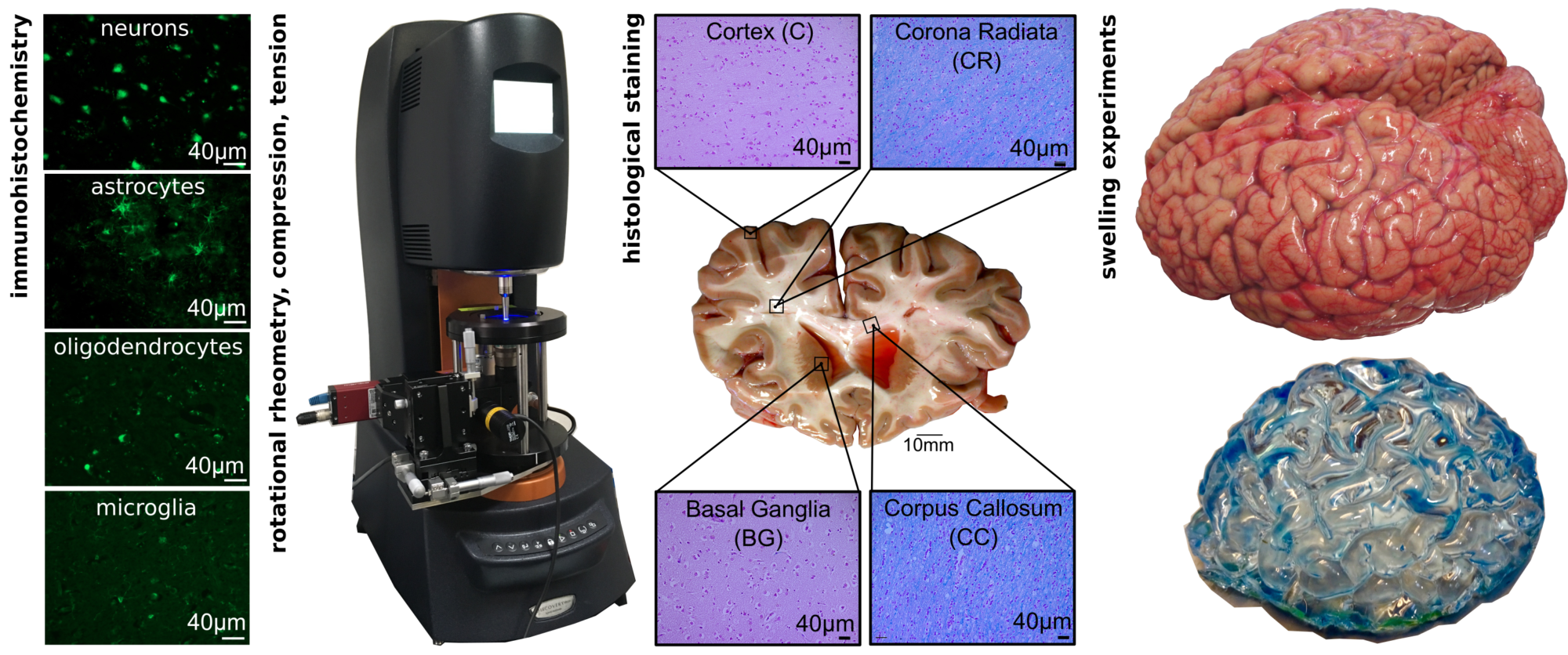 Experiments - BRAINIACS